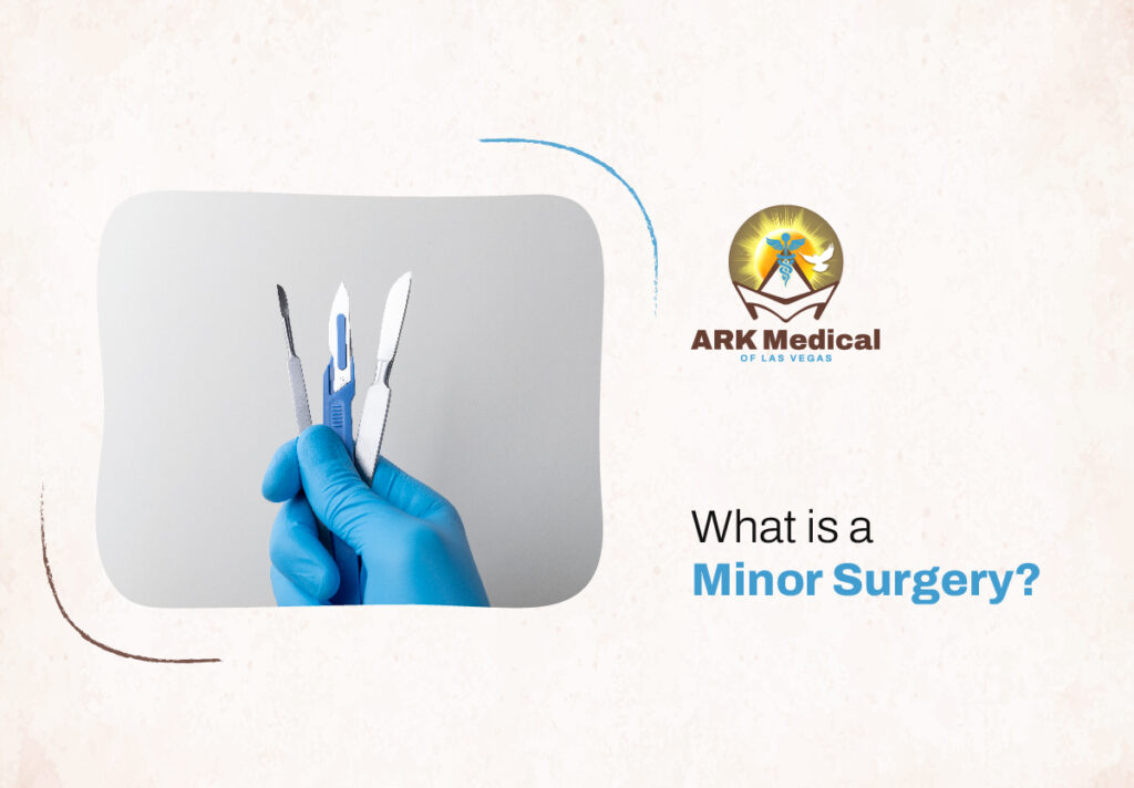 What is a Minor Surgery?