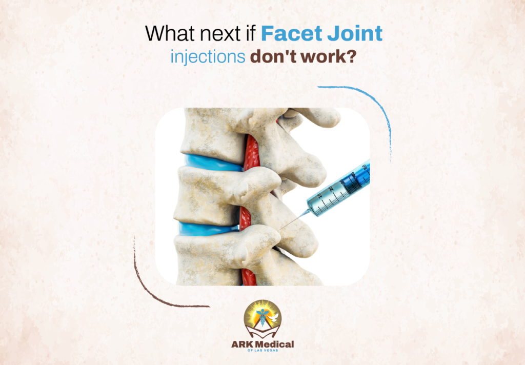 What Next If Facet Joint Injections Don't Work?