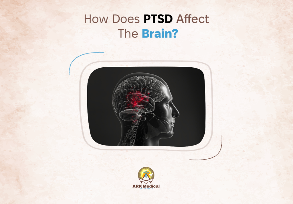 How Does PTSD Affect the Brain