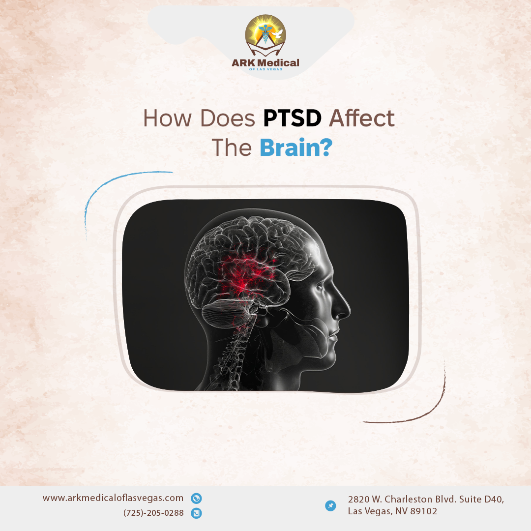 How Does PTSD Affect the Brain